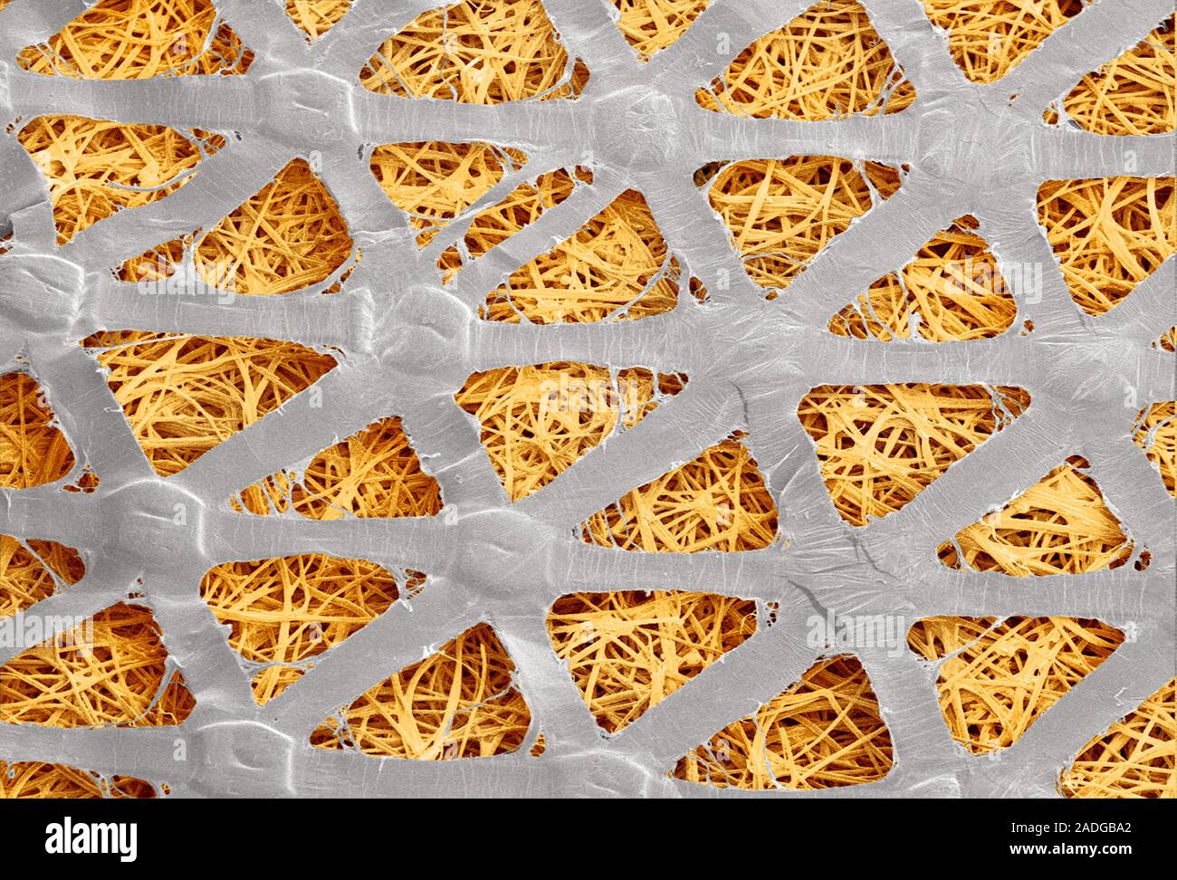 Plaster antiseptic pad. Coloured scanning electron micrograph (SEM) of ...