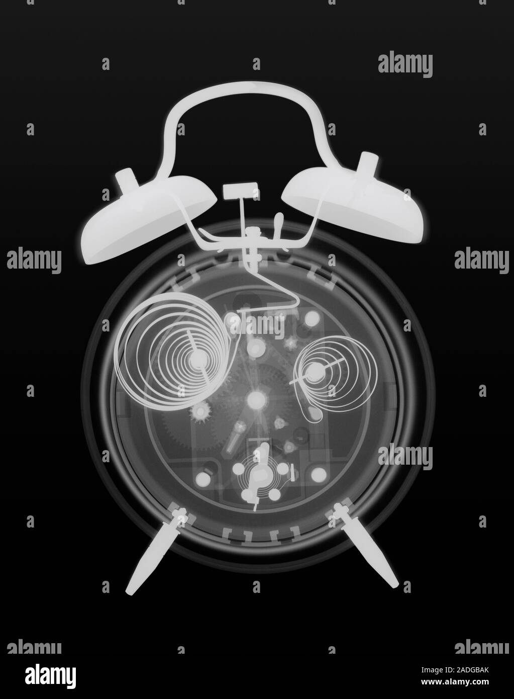Alarm clock, X-ray. Internal cogs and coiled springs (white) are seen ...