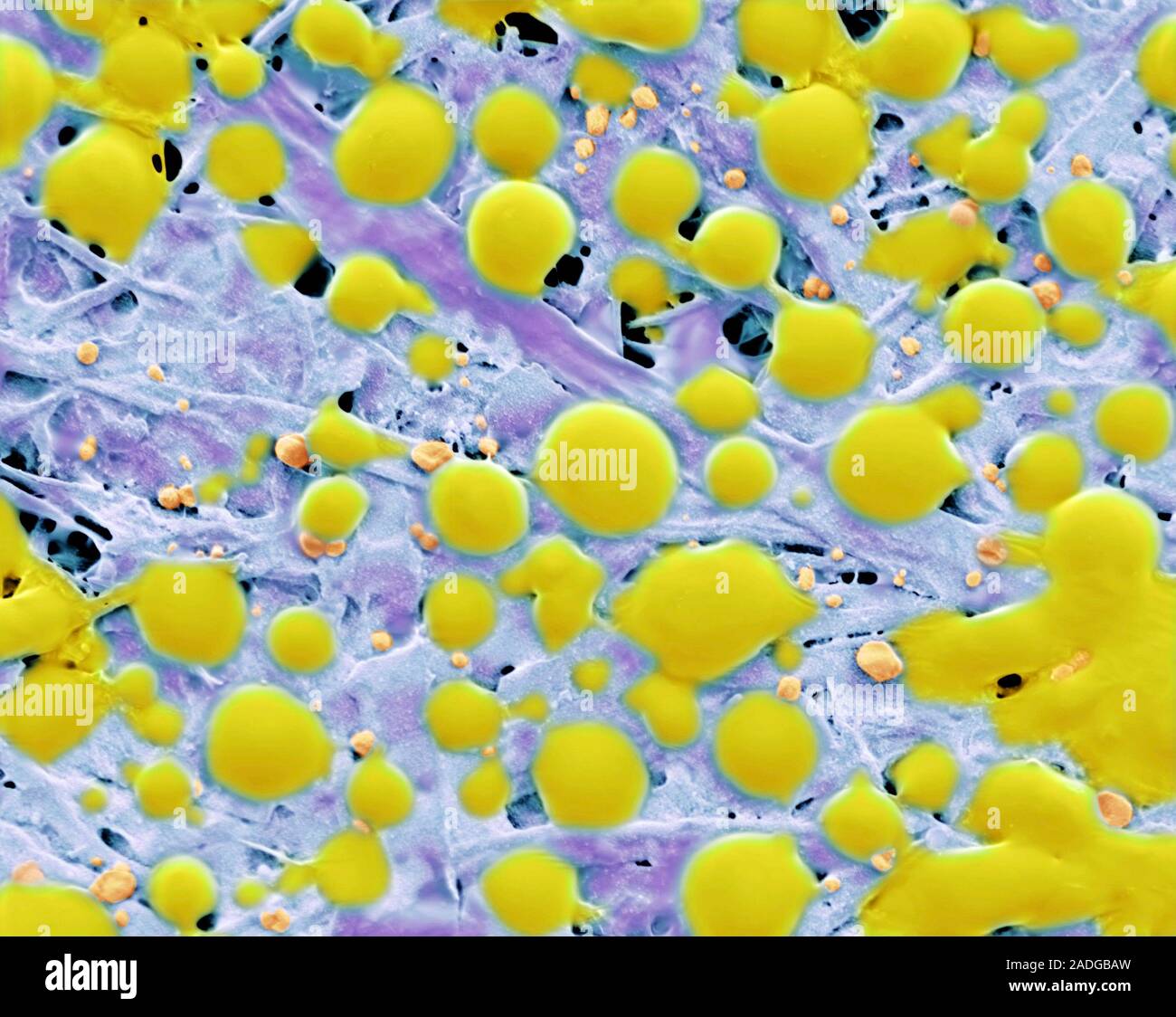 Post-it note. Coloured scanning electron micrograph (SEM) of spheres of ...
