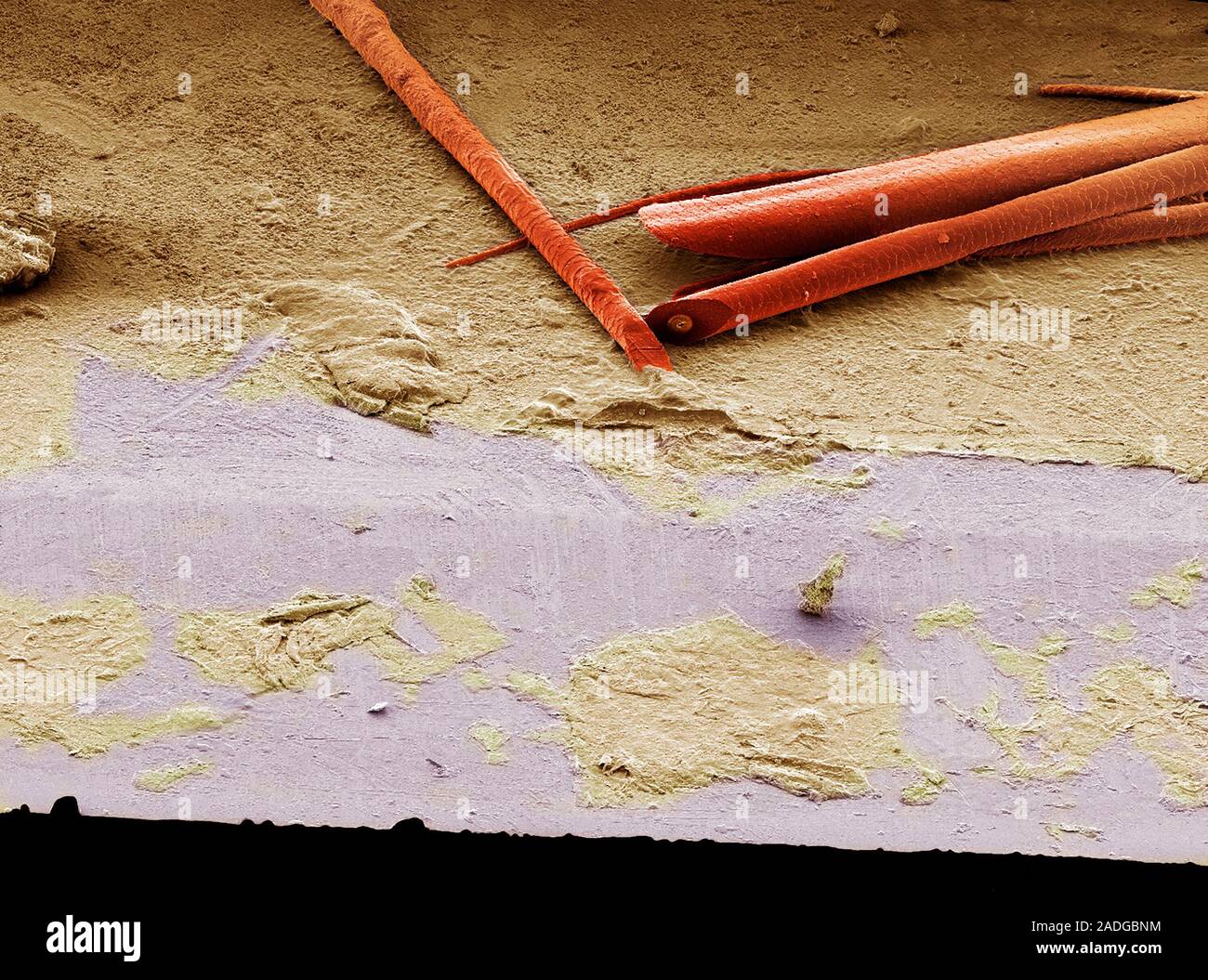 Used razor blade, coloured scanning electron micrograph (SEM). The ...