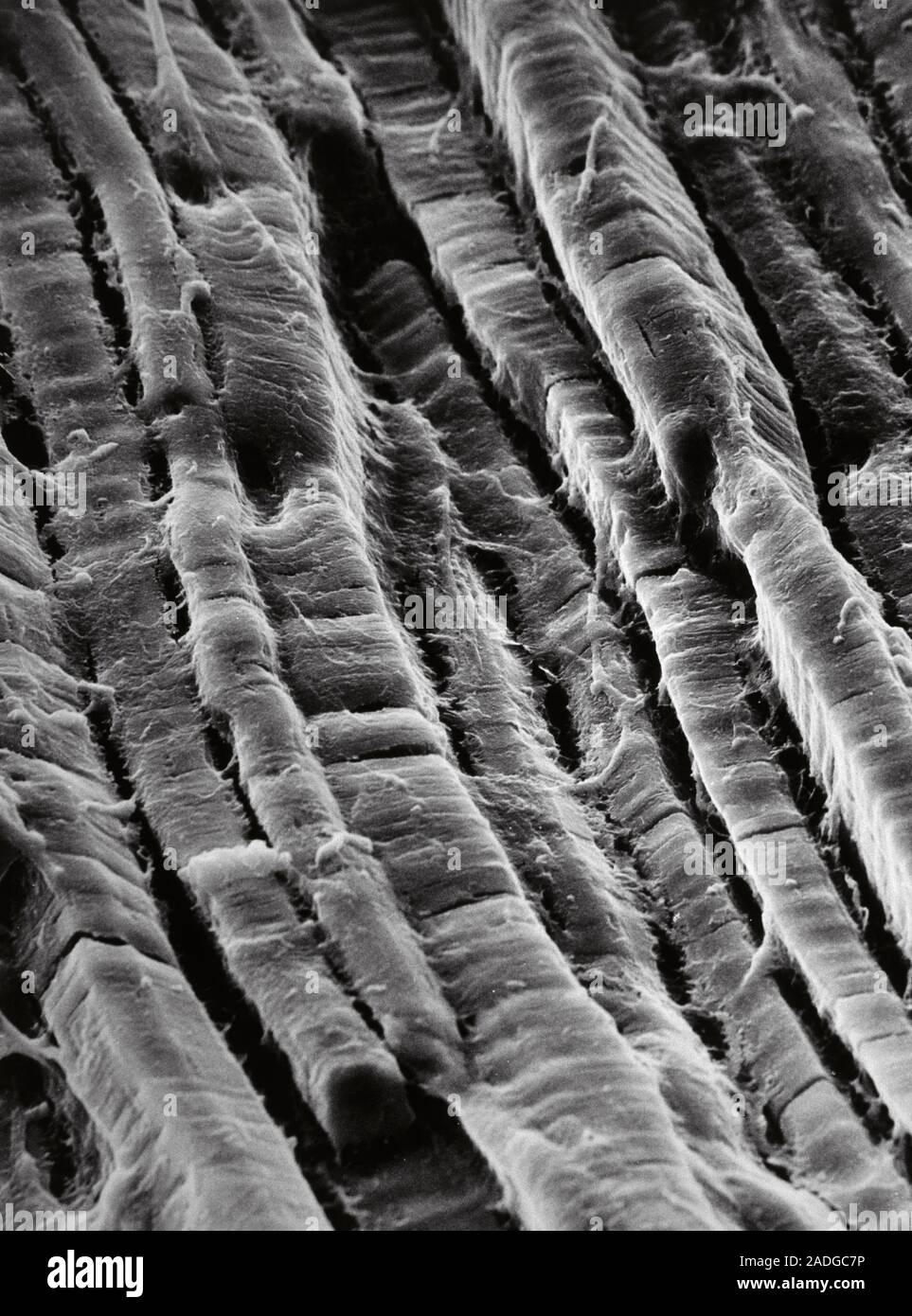 Scanning electron micrograph (SEM) of the surface of a piece of cooked ...