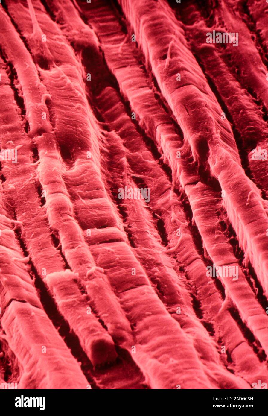 False-colour scanning electron micrograph (SEM) of the surface of a ...
