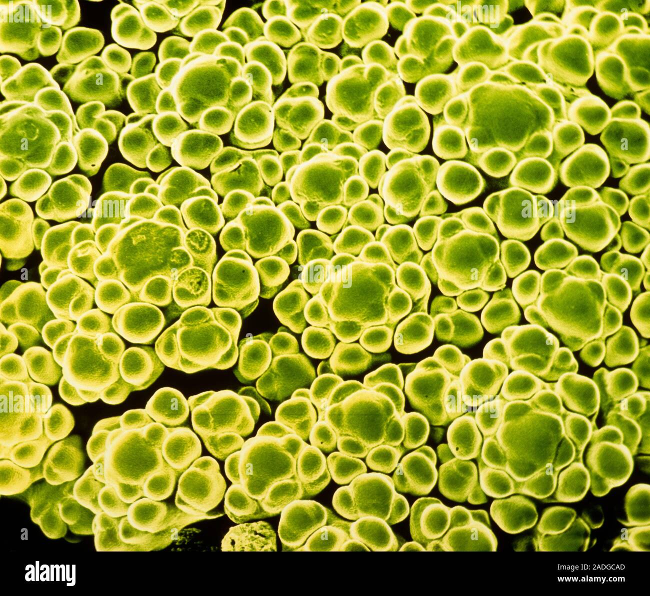 False-colour scanning electron micrograph of the head of a cauliflower ...