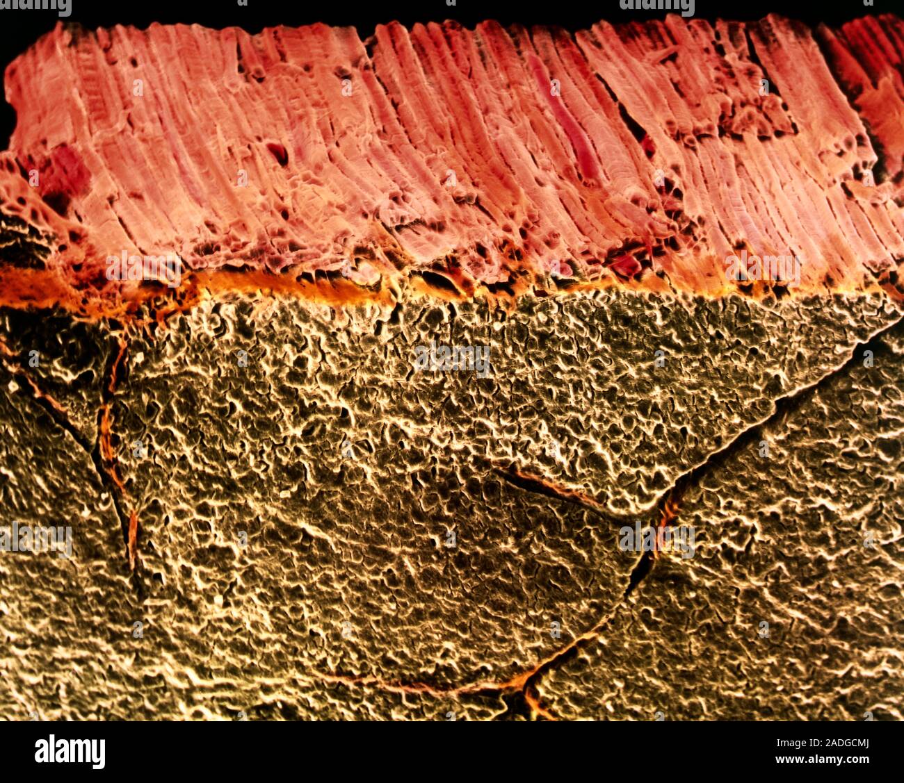 Cooked beef. Coloured scanning electron micrograph (SEM) of the surface ...