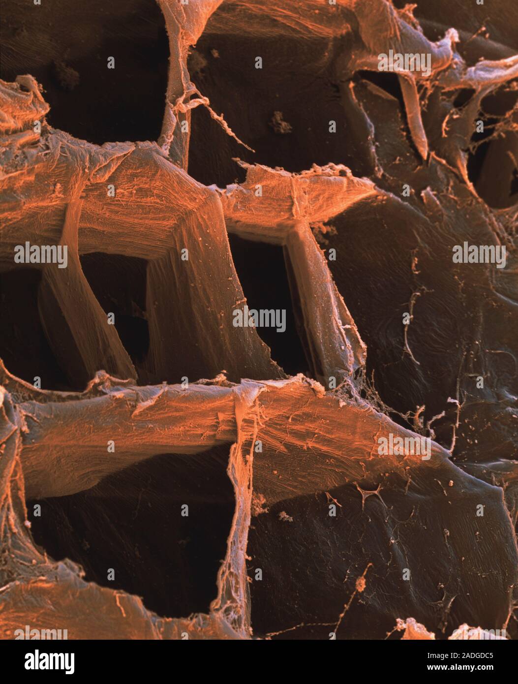 Carrot. Coloured scanning electron micrograph (SEM) of a carrot root ...