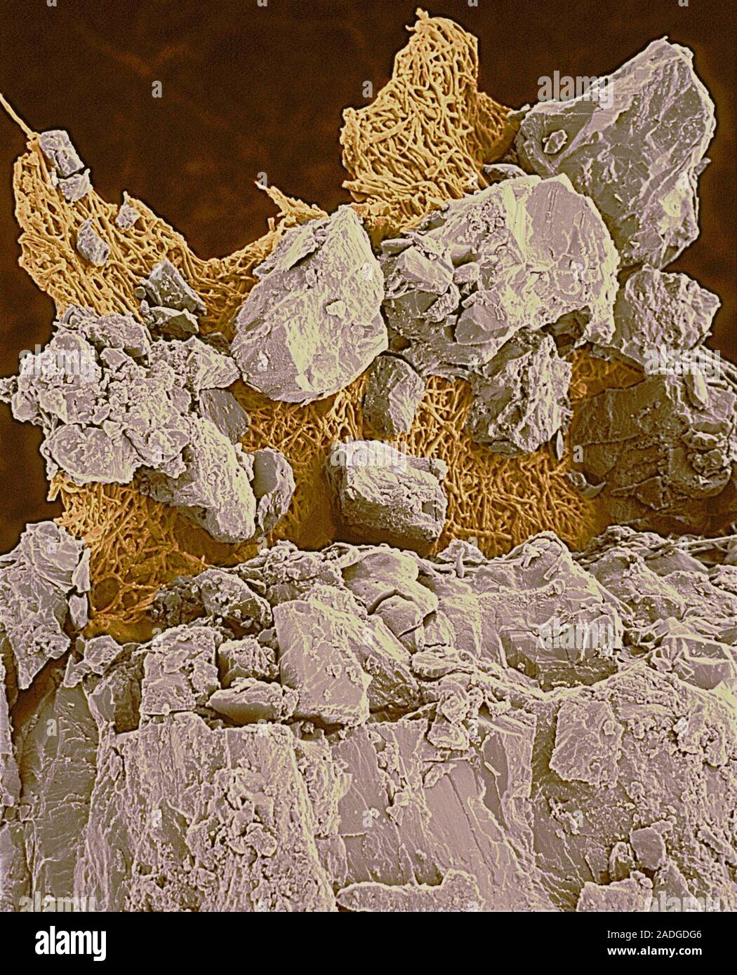 Eggshell. Coloured scanning electron micrograph (SEM) of a broken ...