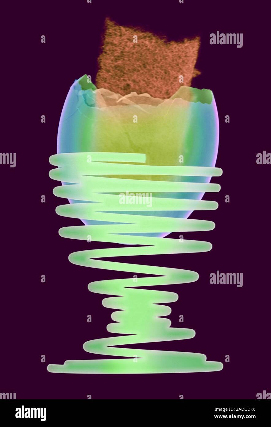 Boiled egg. Coloured X-ray of a boiled egg in a metal egg-cup (coil ...