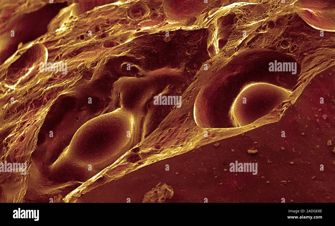 Surface of choc-ice. Scanning electron micrograph (SEM) of the surface ...