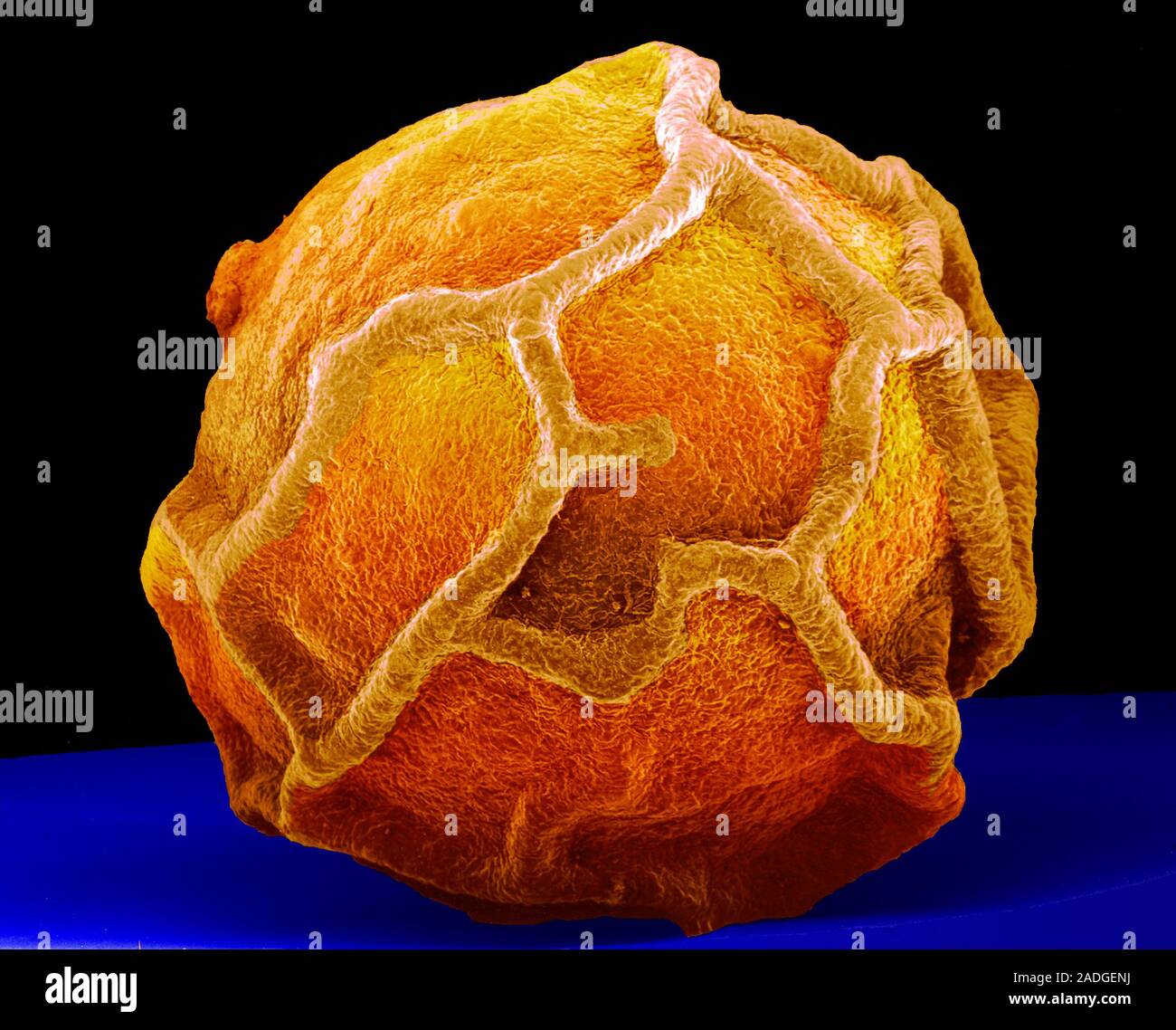 Peppercorn. Coloured scanning electron micrograph (SEM) of a peppercorn ...