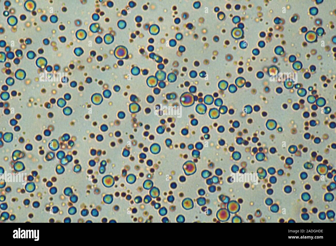 Milk. Light micrograph showing fat globules in full-fat milk ...