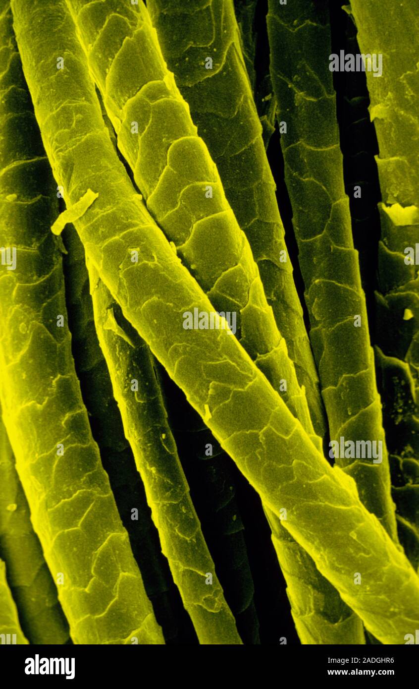 False colour scanning electron micrograph of Shetland wool taken from a ...