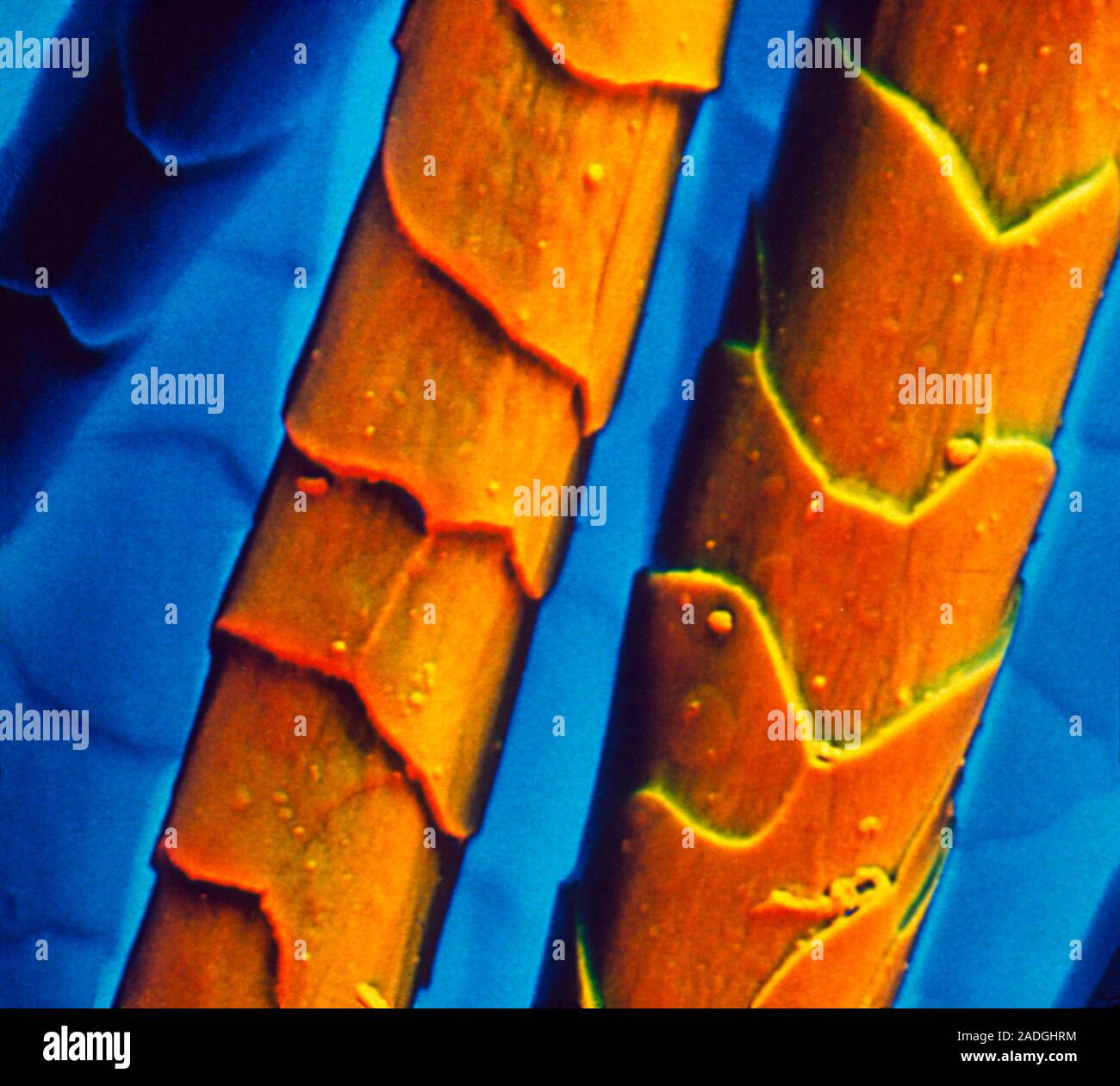 False-colour scanning electron micrograph (SEM) of two strands of ...
