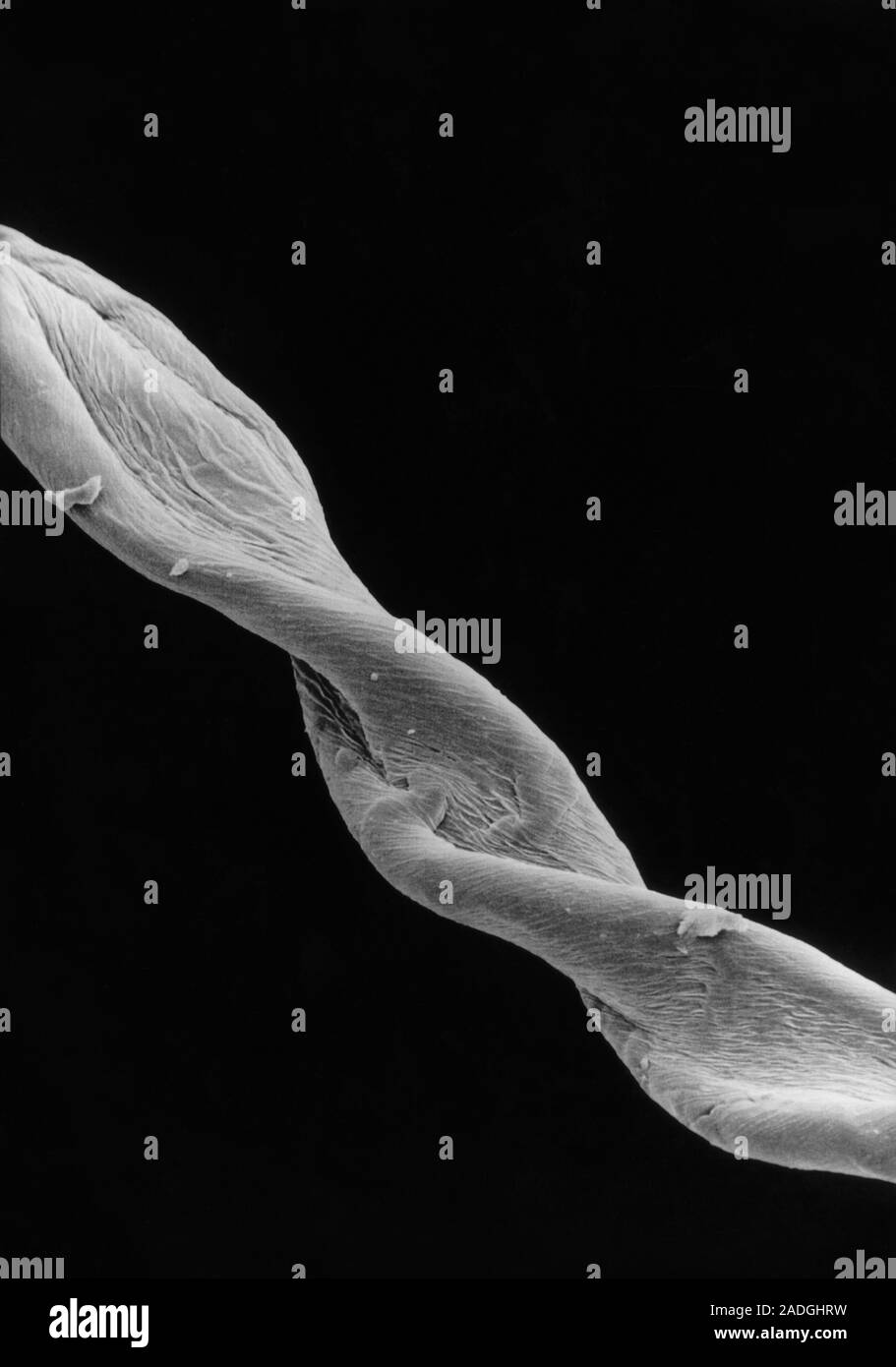 Scanning electron micrograph showing the convolutions in a single ...