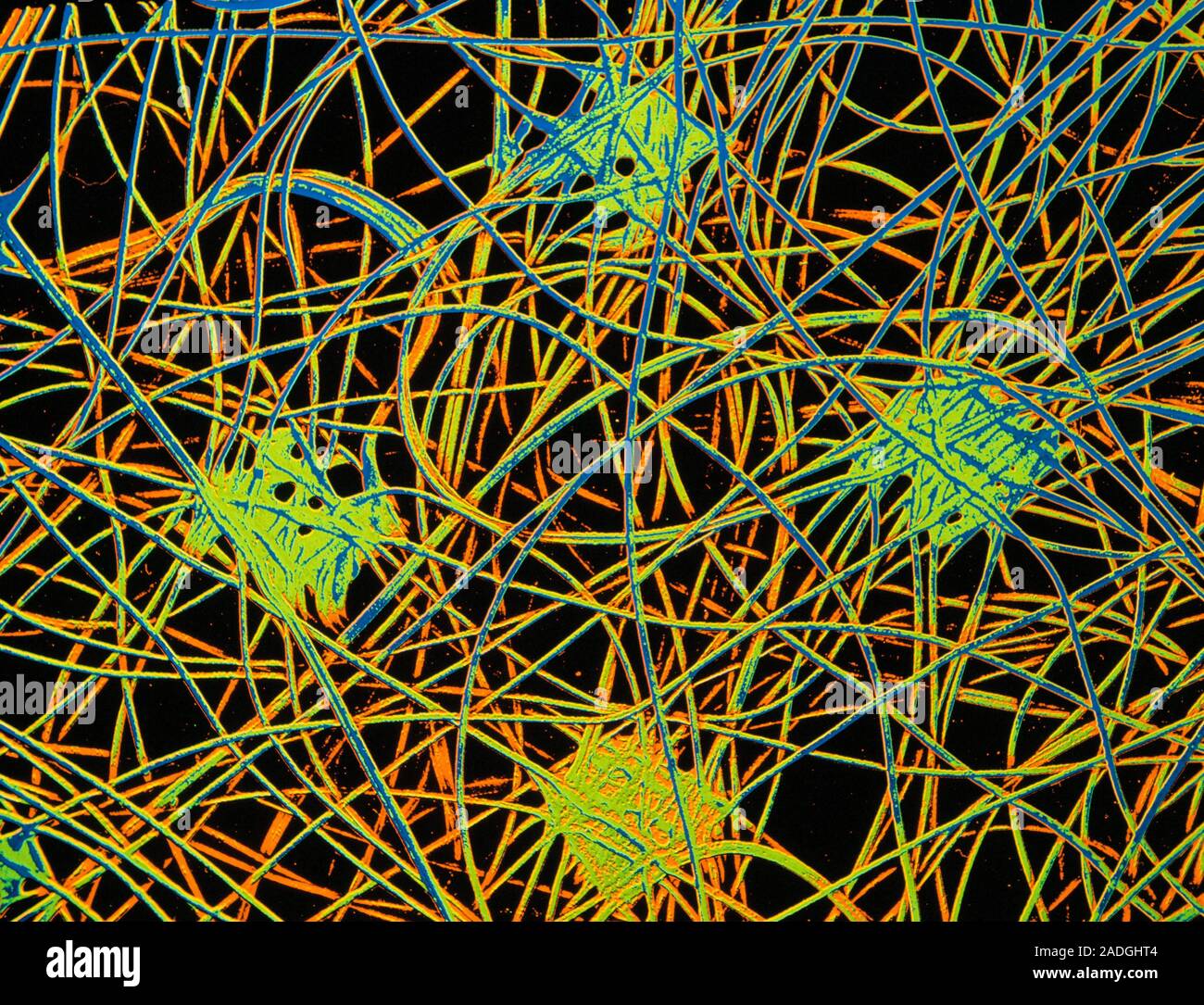 False-colour scanning electron micrograph (SEM) of the detailed ...