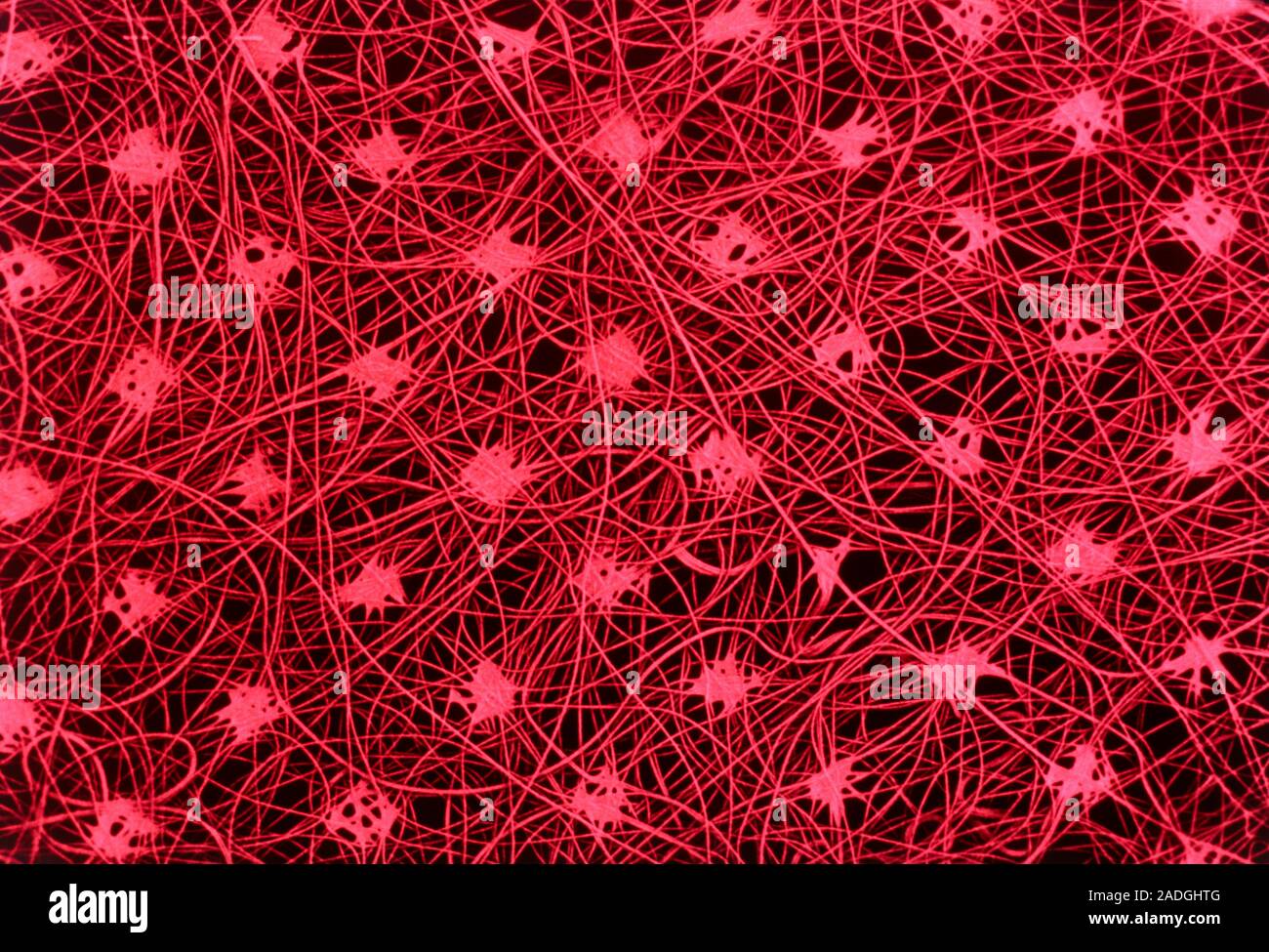 False-colour scanning electron micrograph (SEM) of the detailed ...