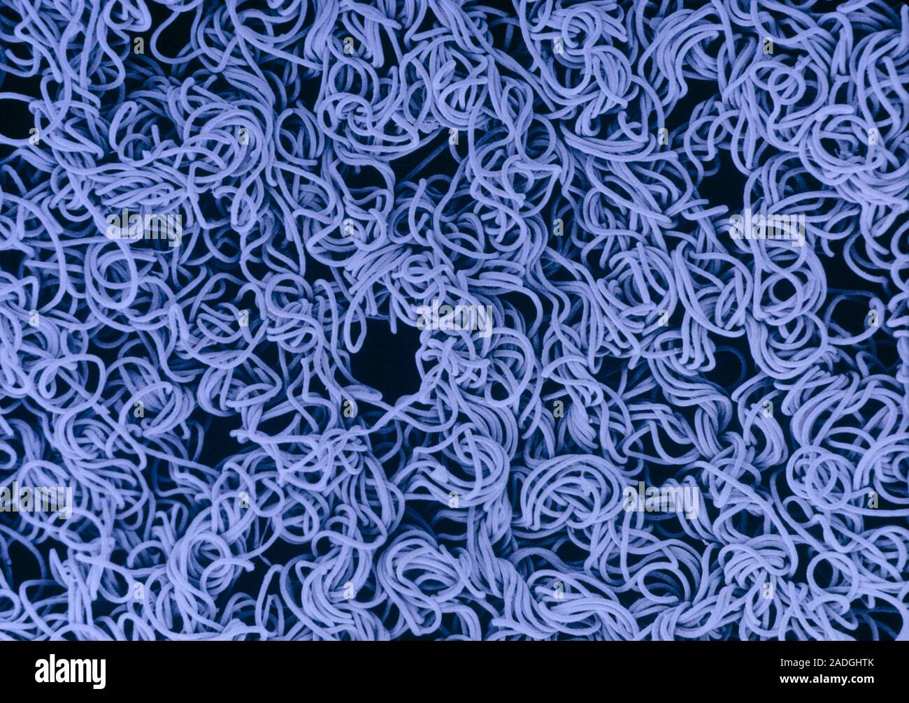 False-colour scanning electron micrograph to show the detailed ...