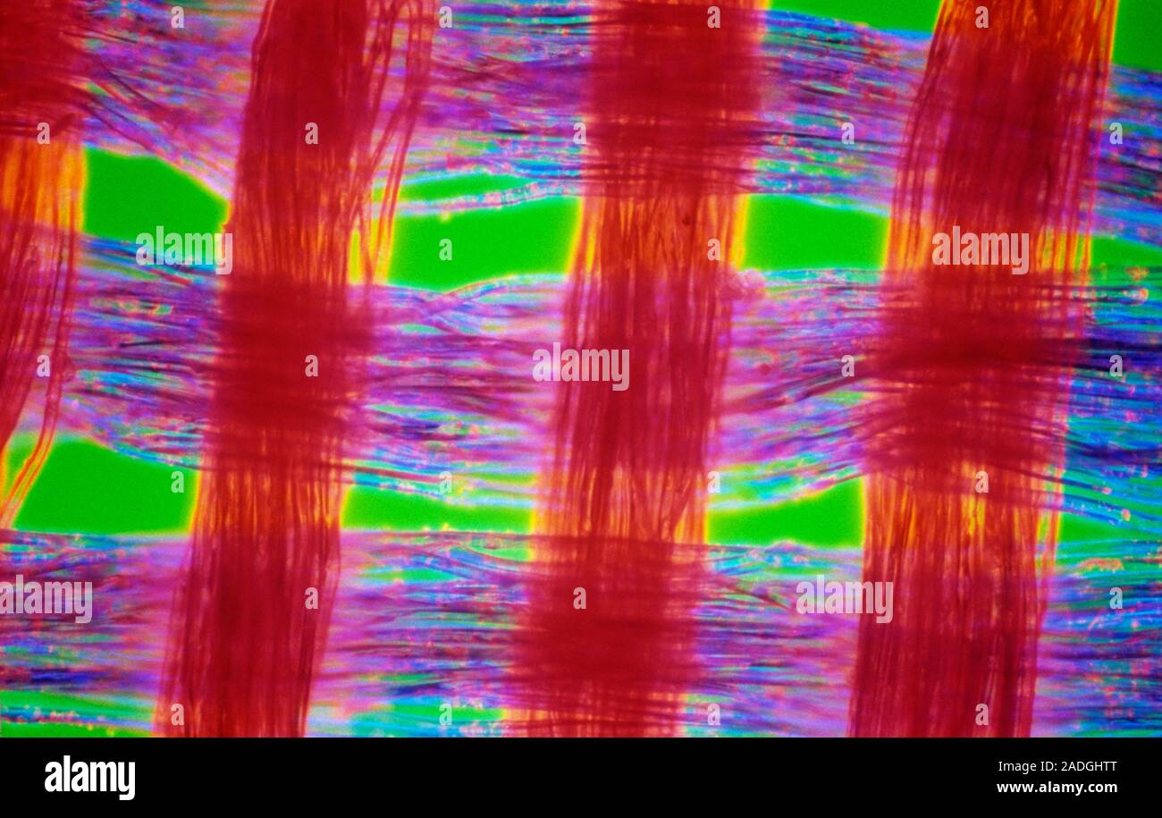 Light micrograph of a piece of woven silk fabric. The threads, an ...