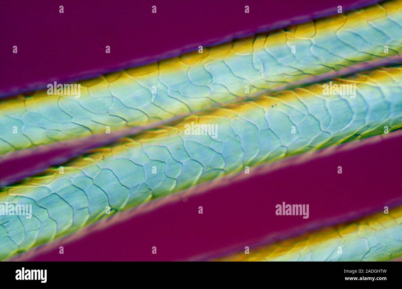 Light micrograph of undyed sheep wool. The hairs are abnormally thick ...
