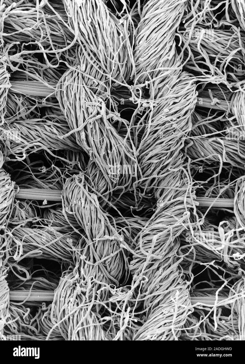 Scanning electron micrograph of a cotton & Lycra mixed fabric. The ...