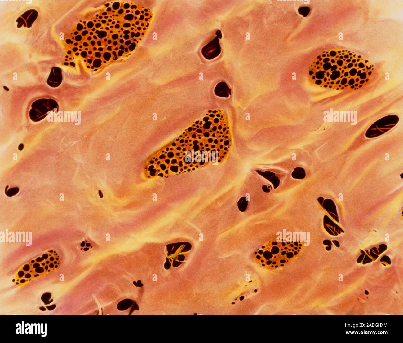 Adhesive dressing. Coloured scanning electron micrograph of the surface ...
