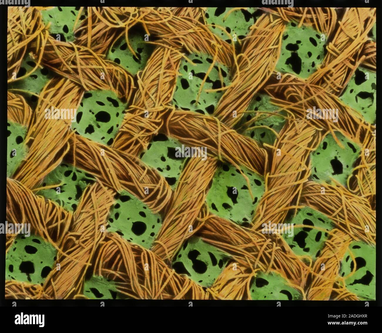Surface of a shoe insole. Coloured scanning electron micrograph of the ...