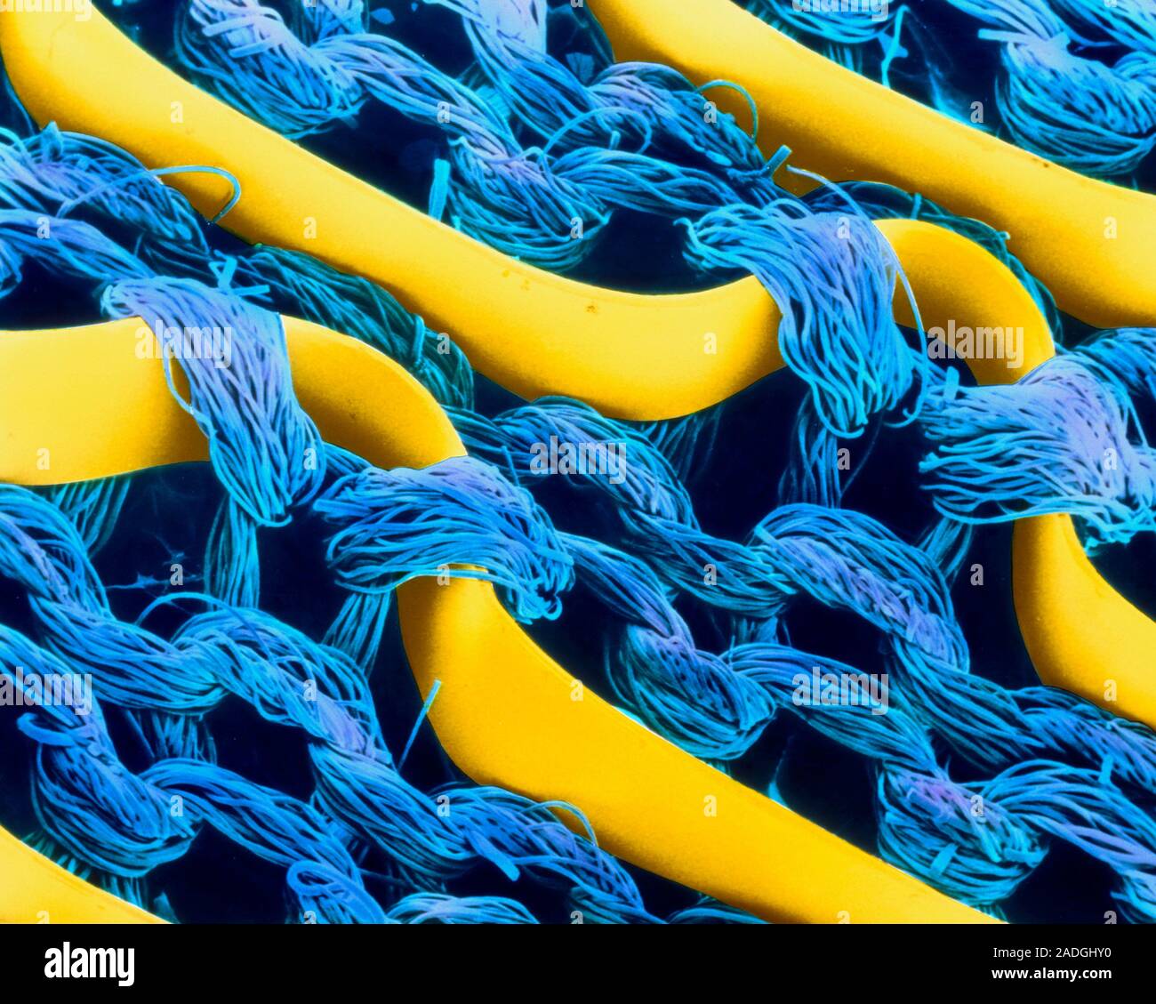 Plastic scourer. Coloured scanning electron micrograph of the fibres of ...