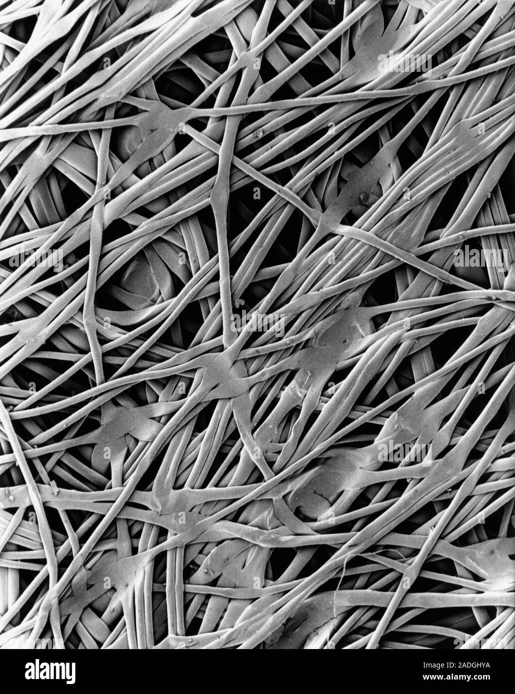 Nylon geotextile. Scanning electron micrograph of fibres of nylon ...