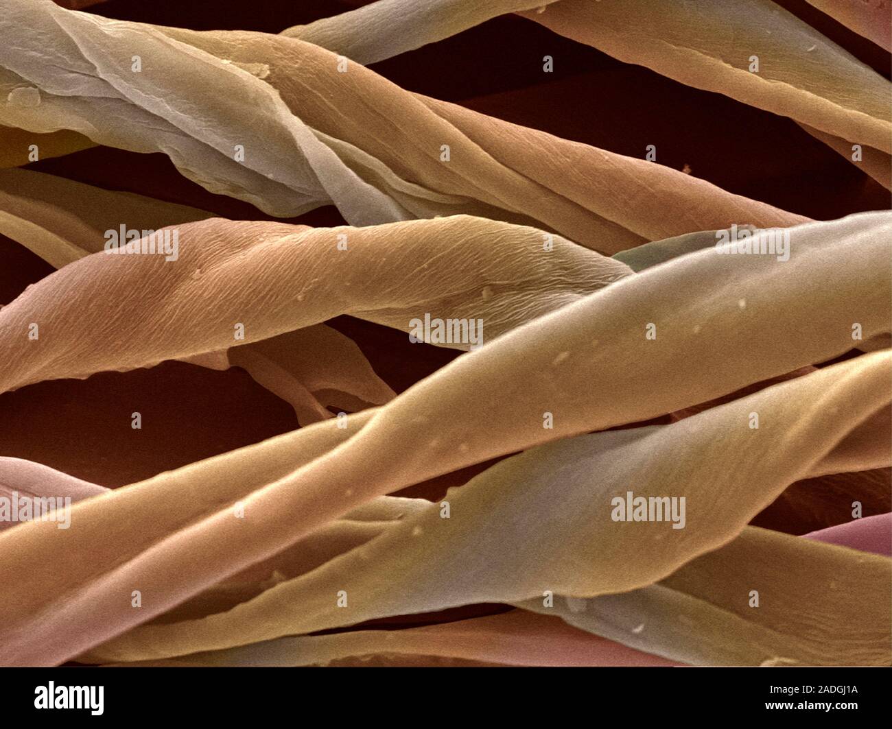 Cotton fibres. Coloured scanning electron micrograph (SEM) of untreated ... Cotton fibres. Coloured scanning electron micrograph (SEM) of untreated ...