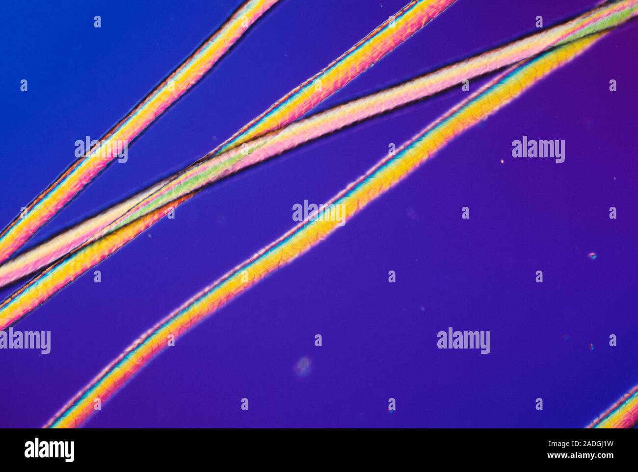 Angora wool fibres, light micrograph. The fibres have overlapping ...