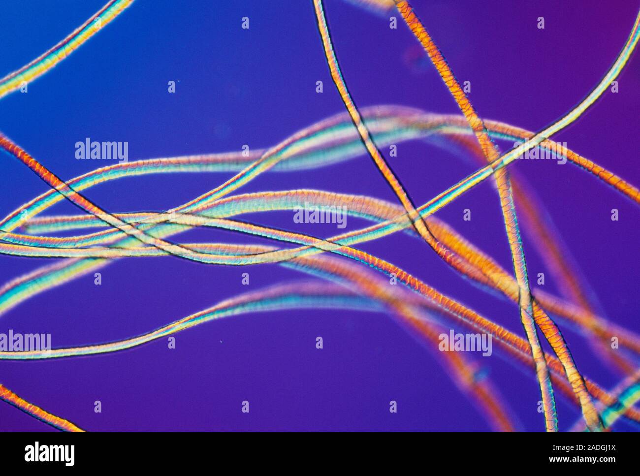 Merino wool fibres, light micrograph. The fibres have overlapping ...