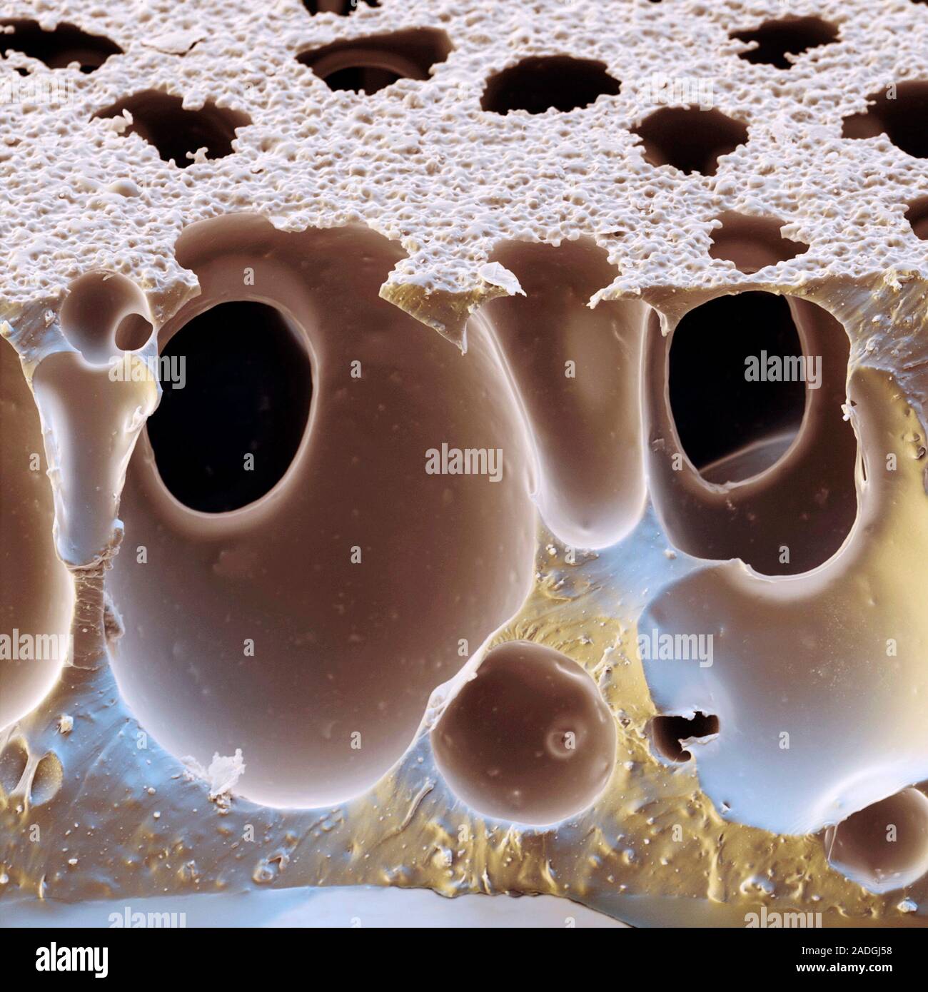 Wound dressing. Coloured scanning electron micrograph (SEM) of ...