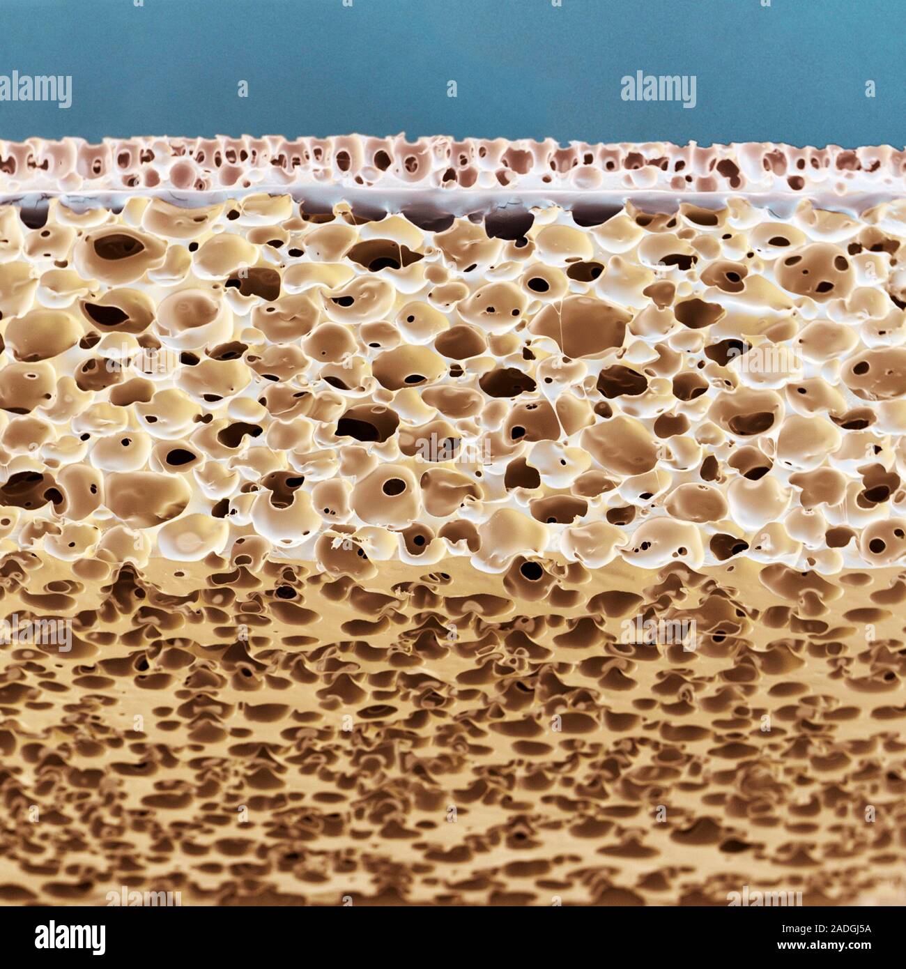 Wound dressing. Coloured scanning electron micrograph (SEM) of ...