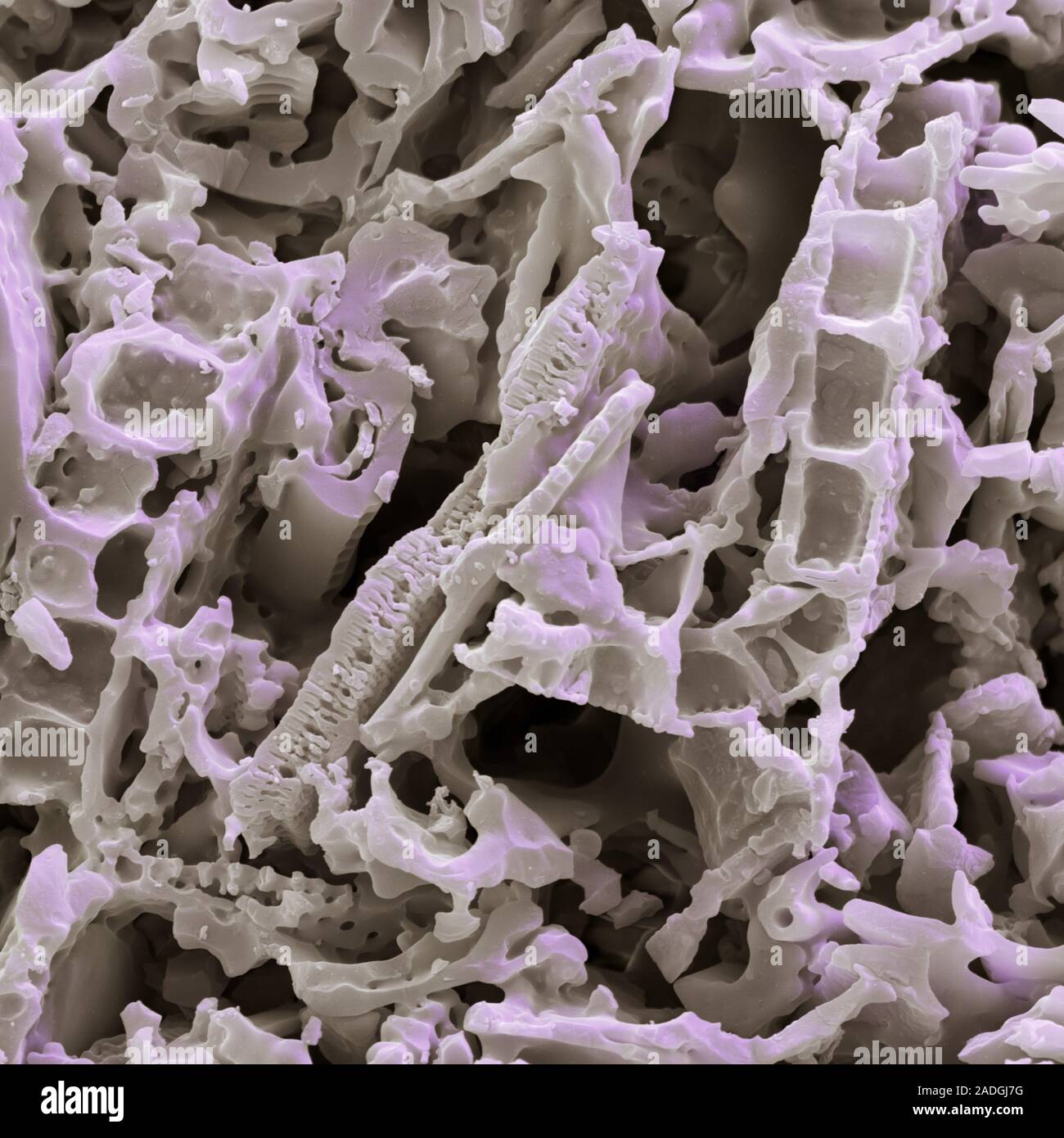 Ceramic filter, coloured scanning electron micrograph (SEM). This ...