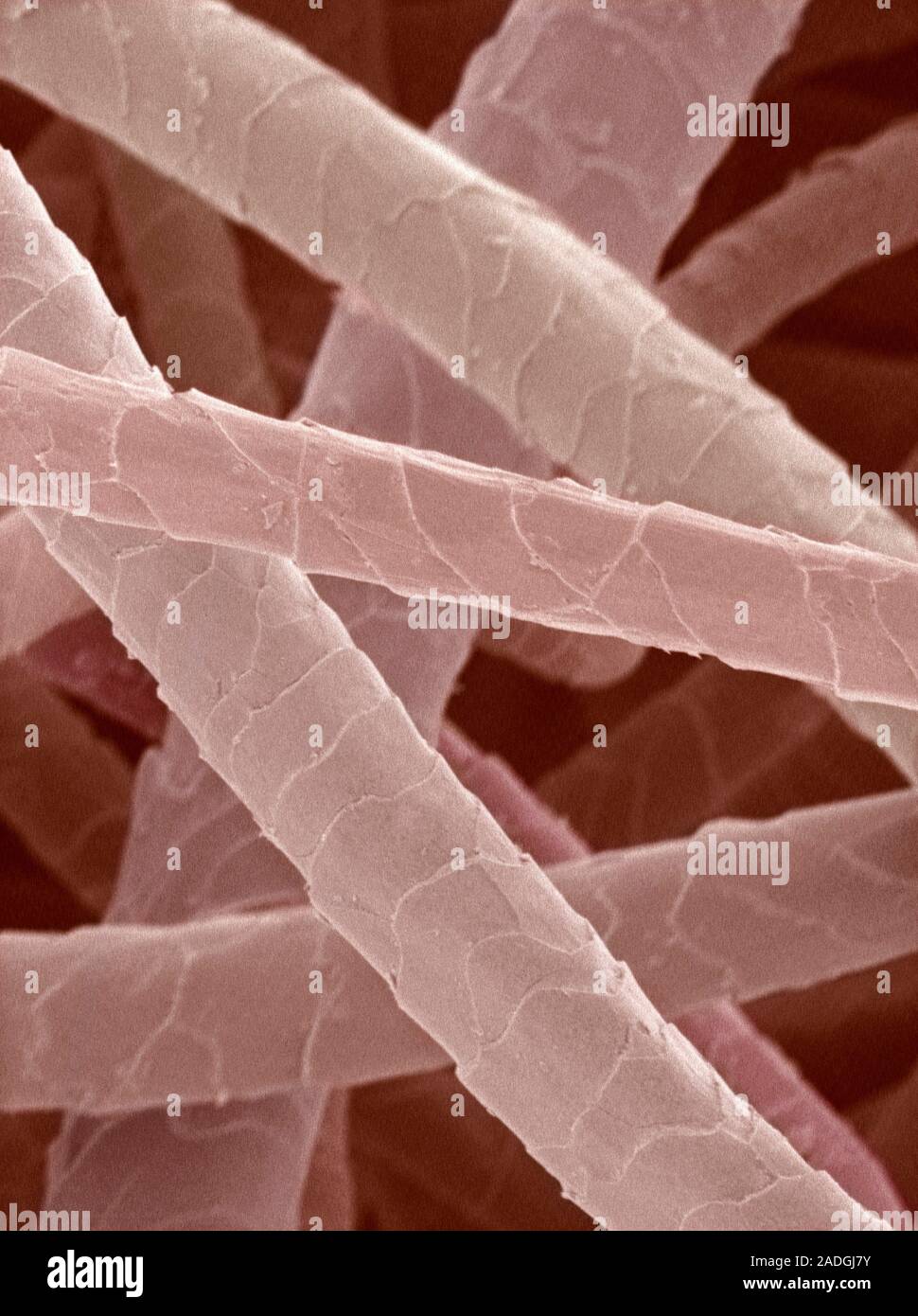 Wool. Coloured scanning electron micrograph (SEM) of wool from a sheep ... Wool. Coloured scanning electron micrograph (SEM) of wool from a sheep ...