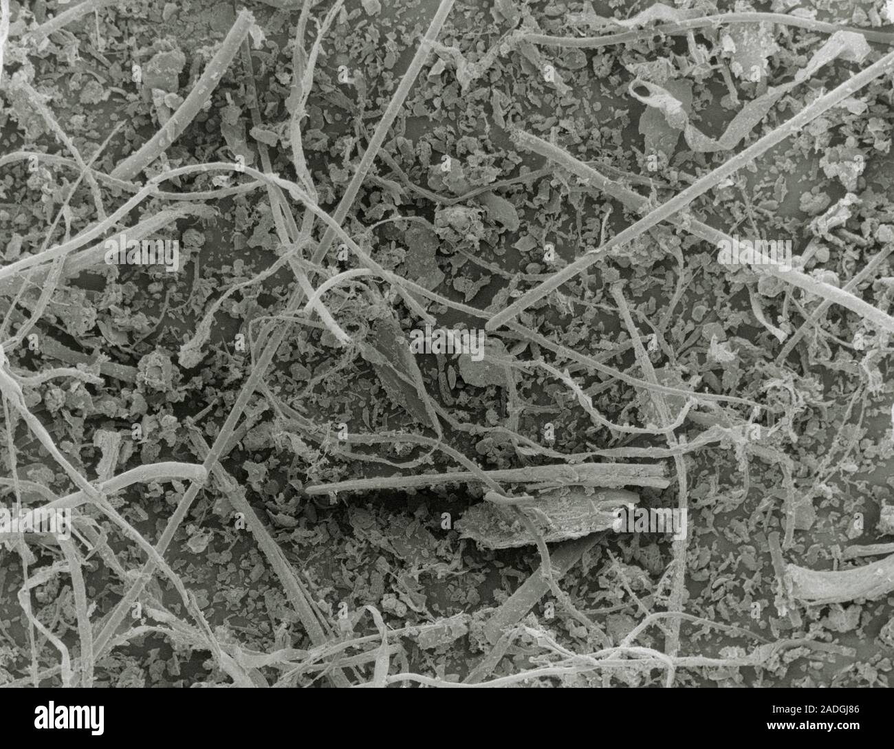 Scanning electron micrograph (SEM) of a sample of household dust taken ...