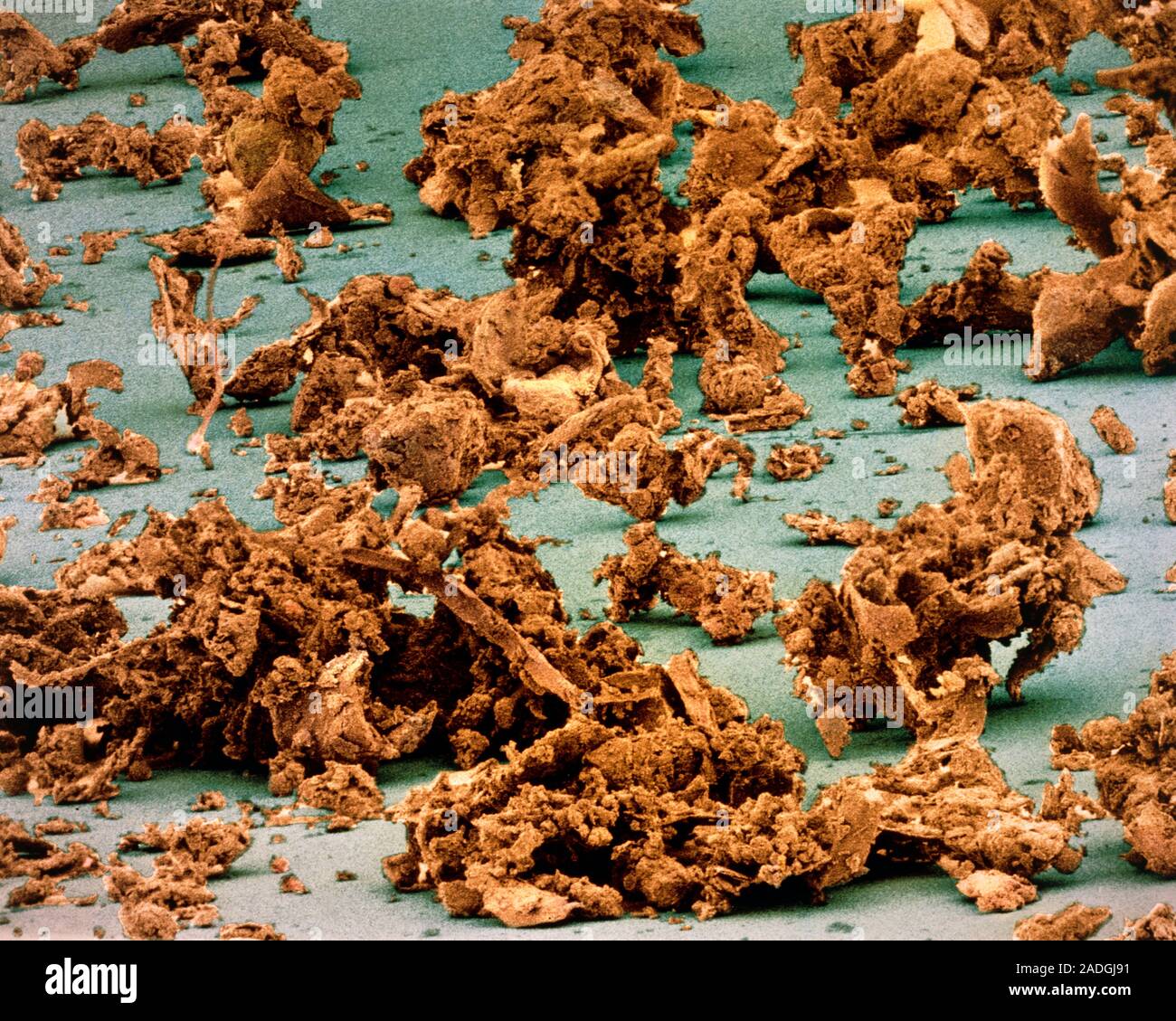 False colour scanning electron micrograph (SEM) of household dust ...