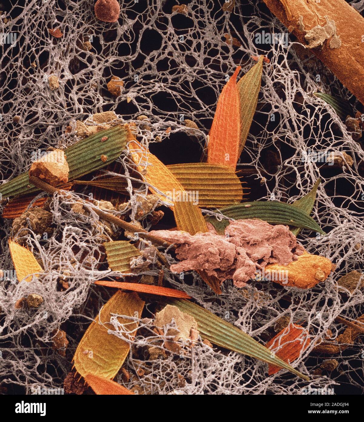 False colour scanning electron micrograph (SEM) of a sample of ...