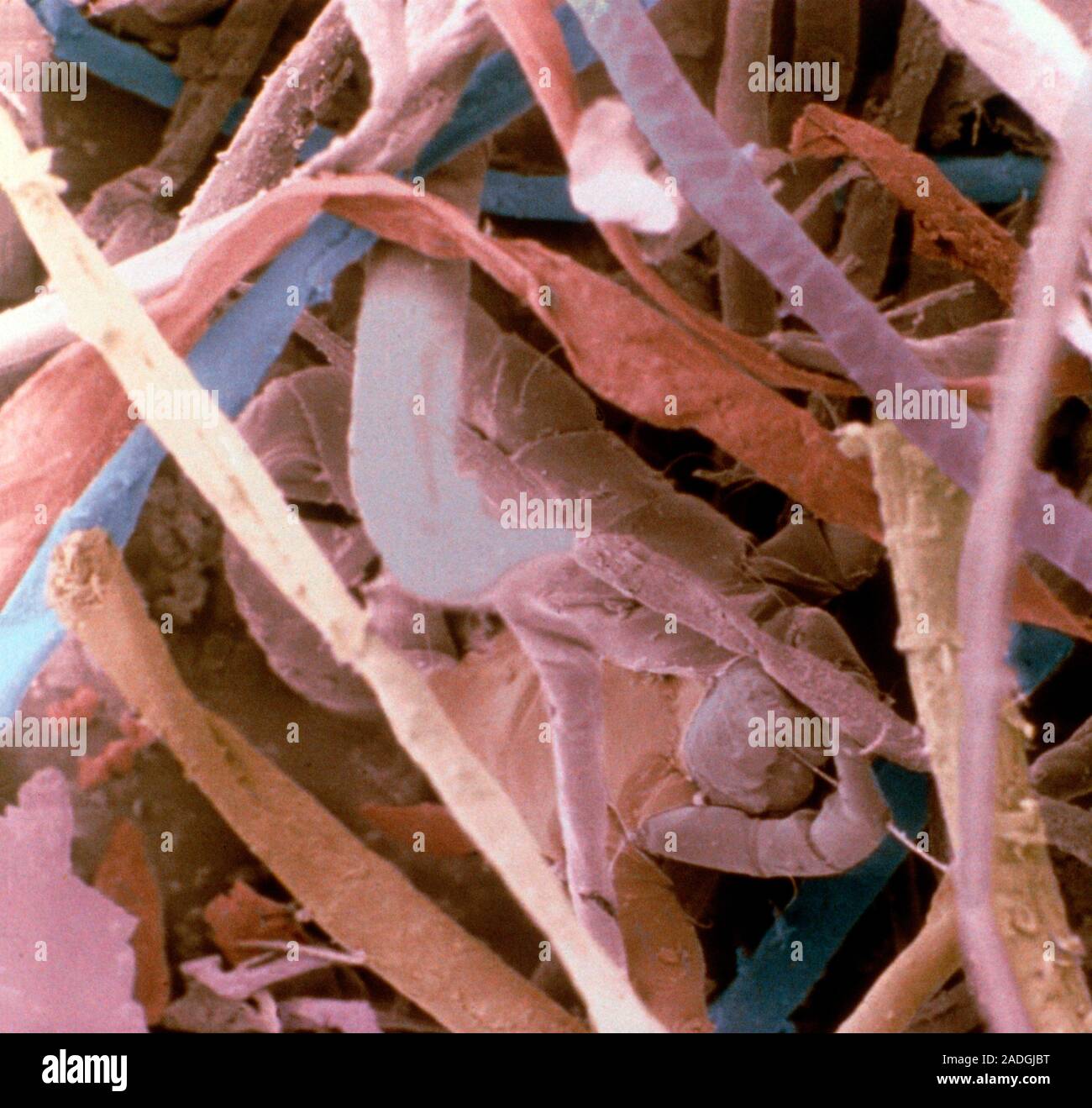House dust. Coloured scanning electron micrograph (SEM) of household ...