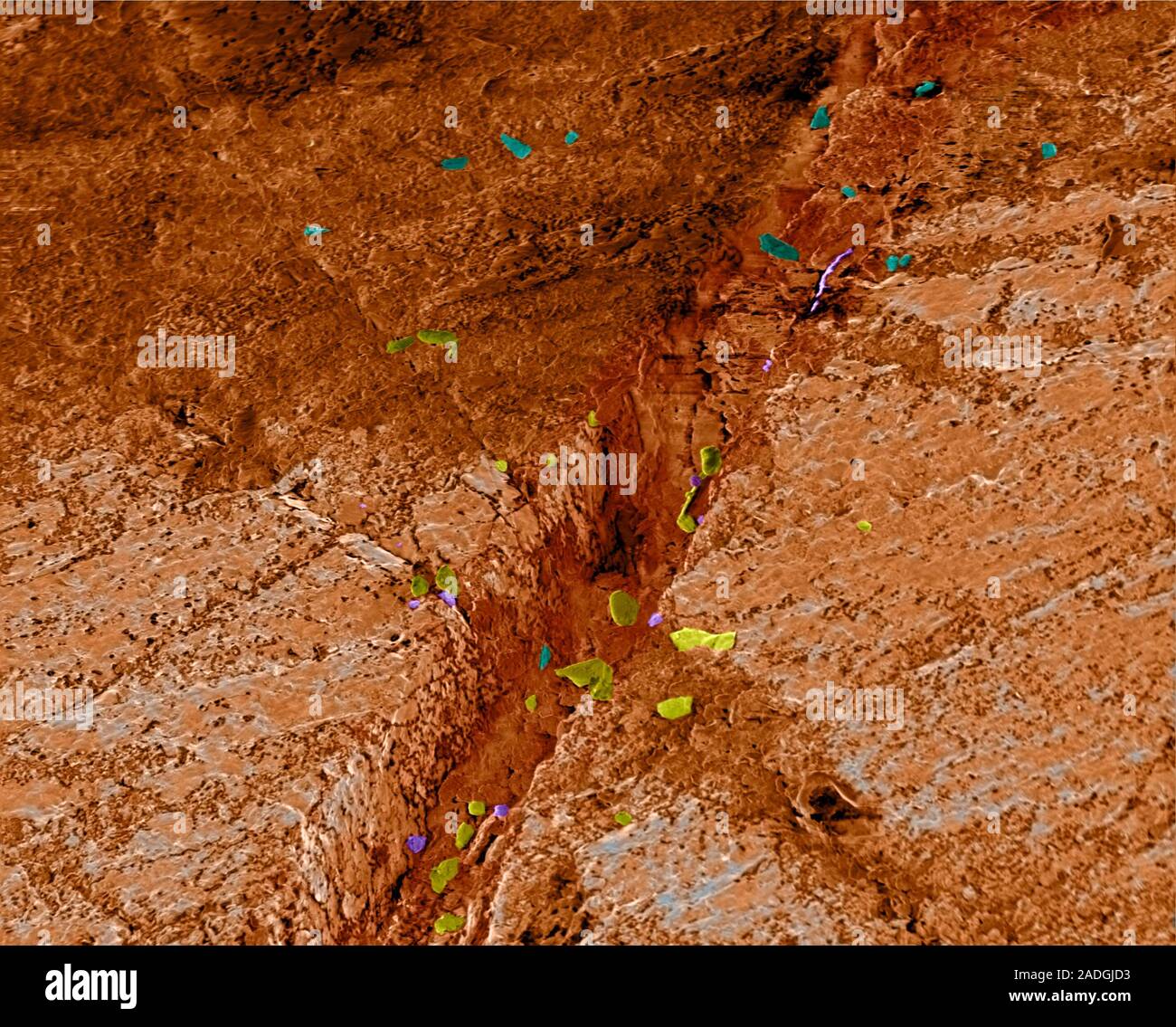 Dirty chopping board. Coloured scanning electron micrograph (SEM) of ...