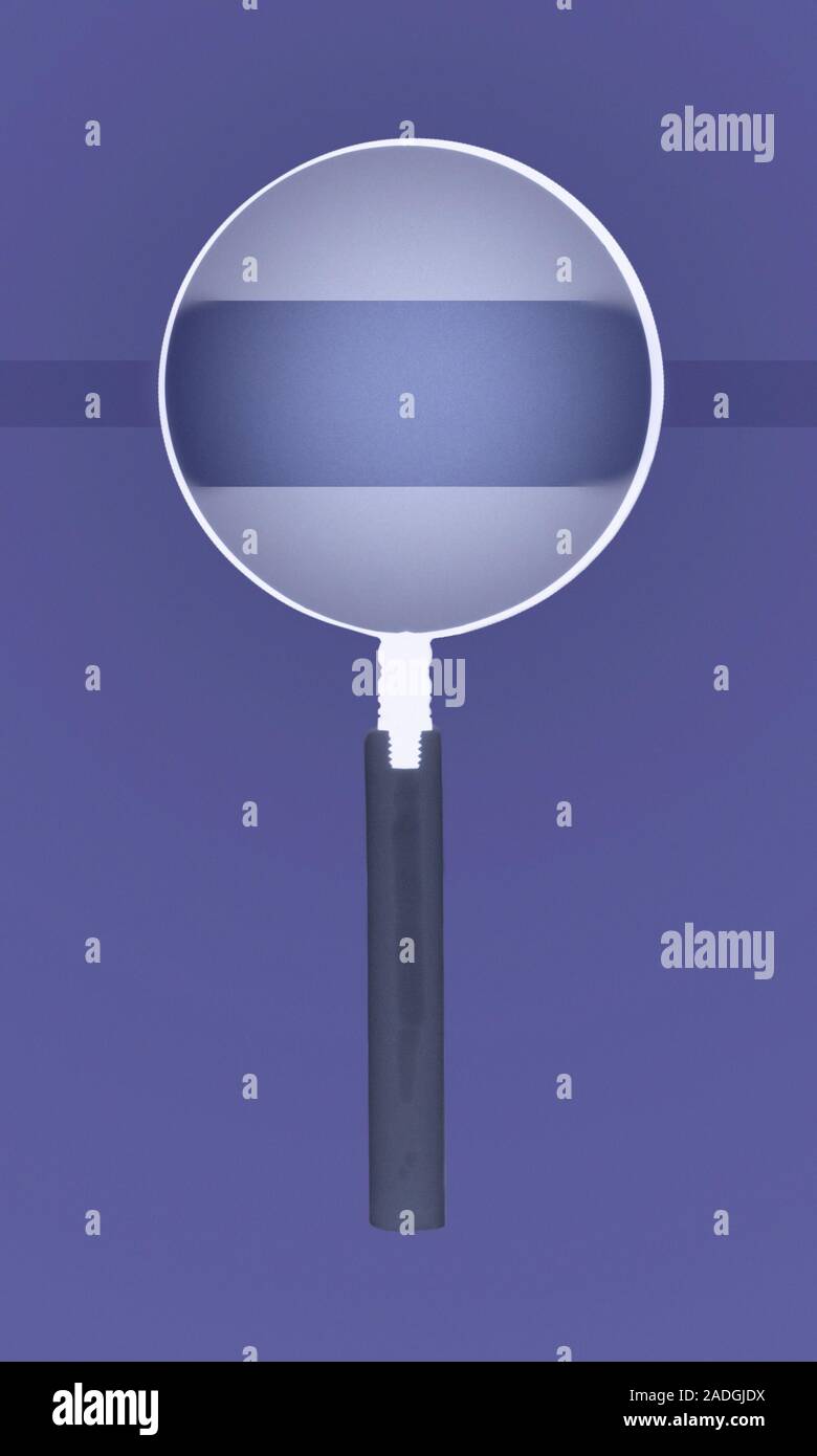 Magnifying glass, coloured X-ray Stock Photo - Alamy