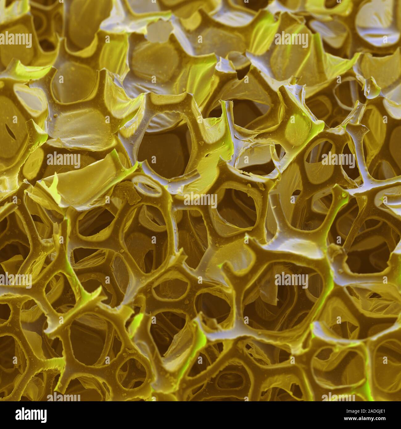 Household sponge. Coloured scanning electron micrograph (SEM) of a ...
