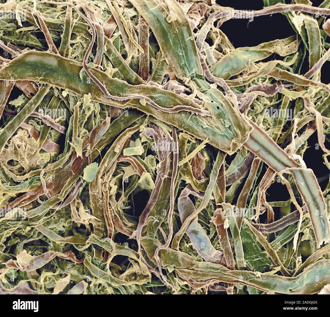 Toilet paper. Coloured scanning electron micrograph (SEM) of the paper ...