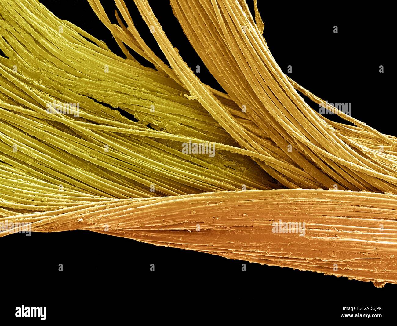 Dental floss. Coloured scanning electron micrograph (SEM) of unwound ...