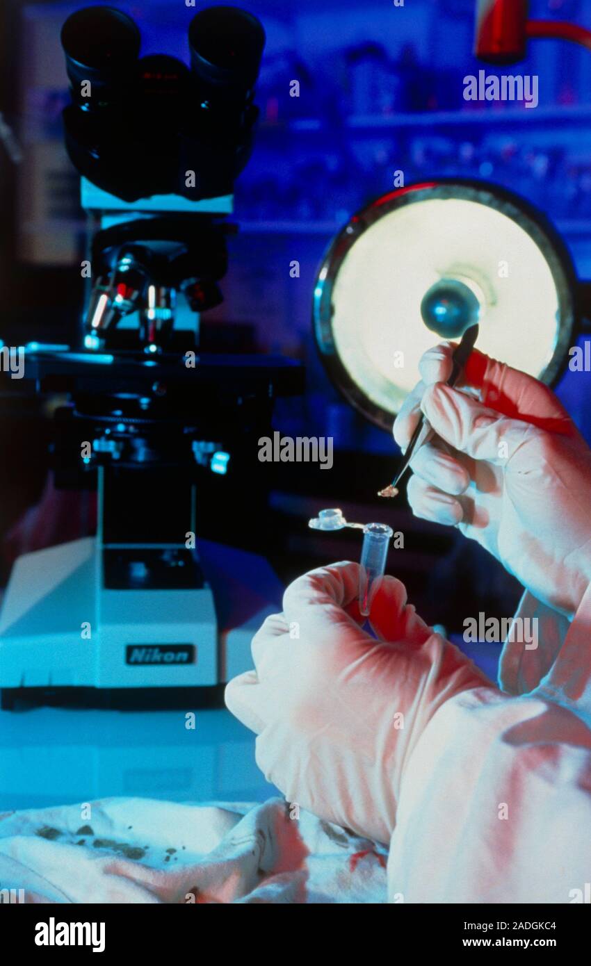 Forensic blood sample. A forensic scientist delicately places a ...
