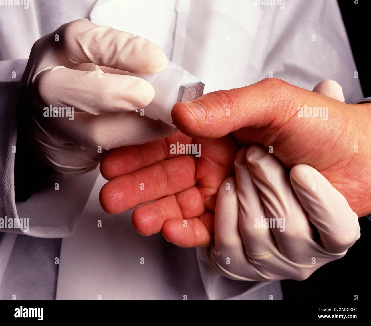 Looking for gunshot residue (GSR). GSR stub being used to sample a ...