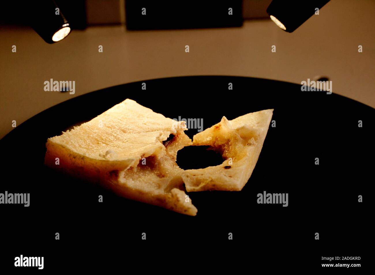 Skull bullet wound analysis. Fragment of bone from the skull of a ...