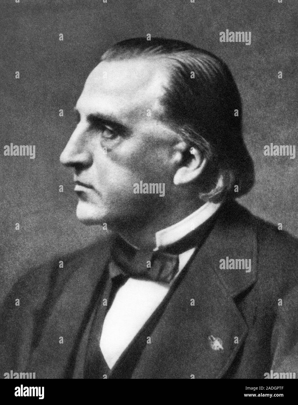 Jean-Martin Charcot (1825-1893), French neurologist. In 1863, Charcot ...