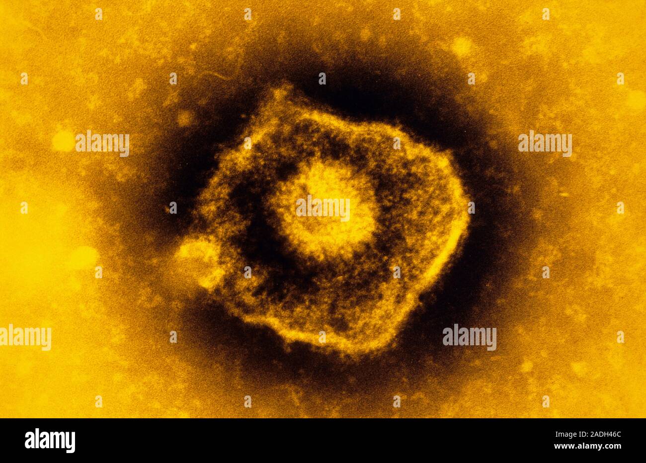Varicella-zoster virus. Coloured Transmission Electron Micrograph (TEM ...