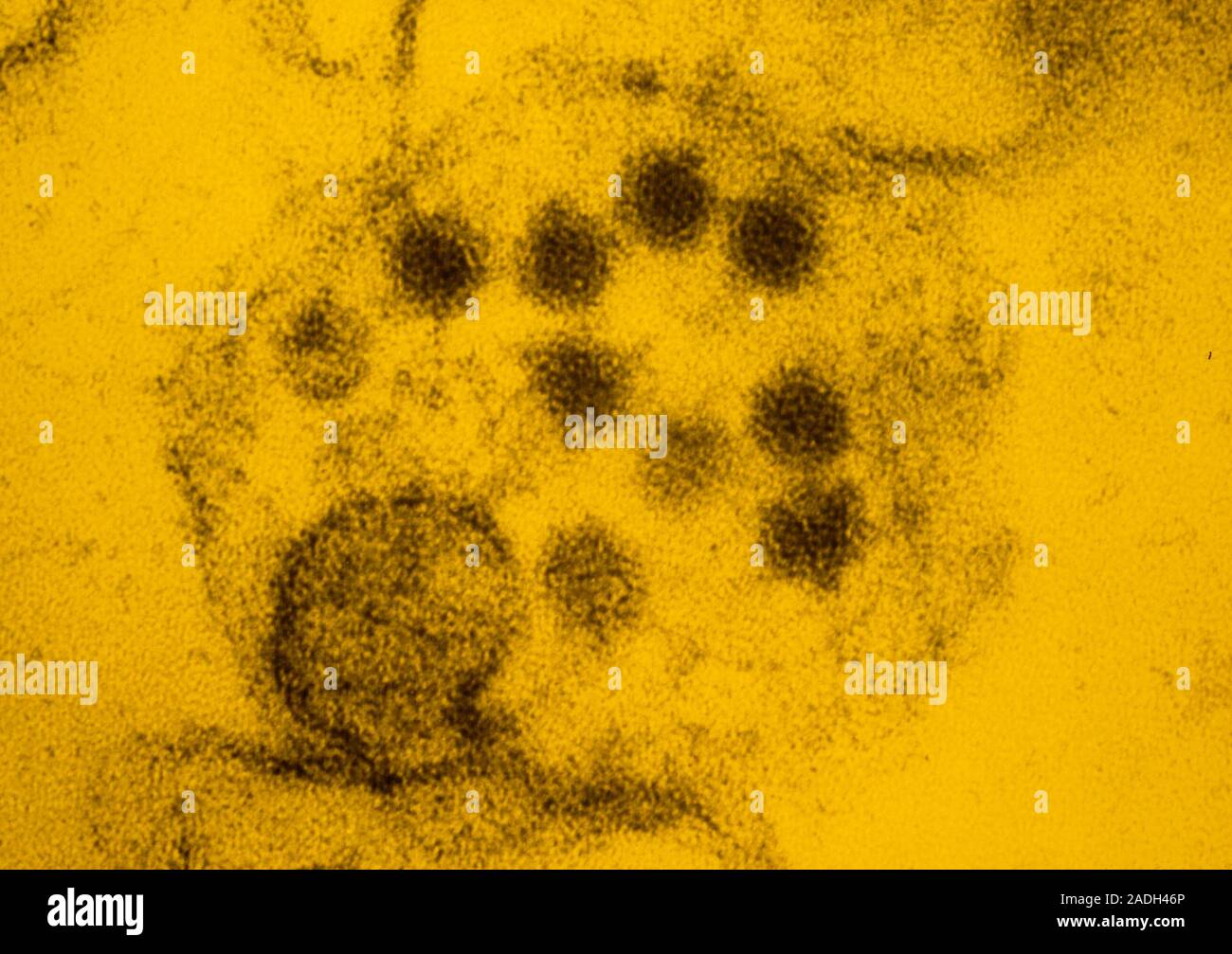 False colour transmission electron micrograph (TEM) of yellow fever ...