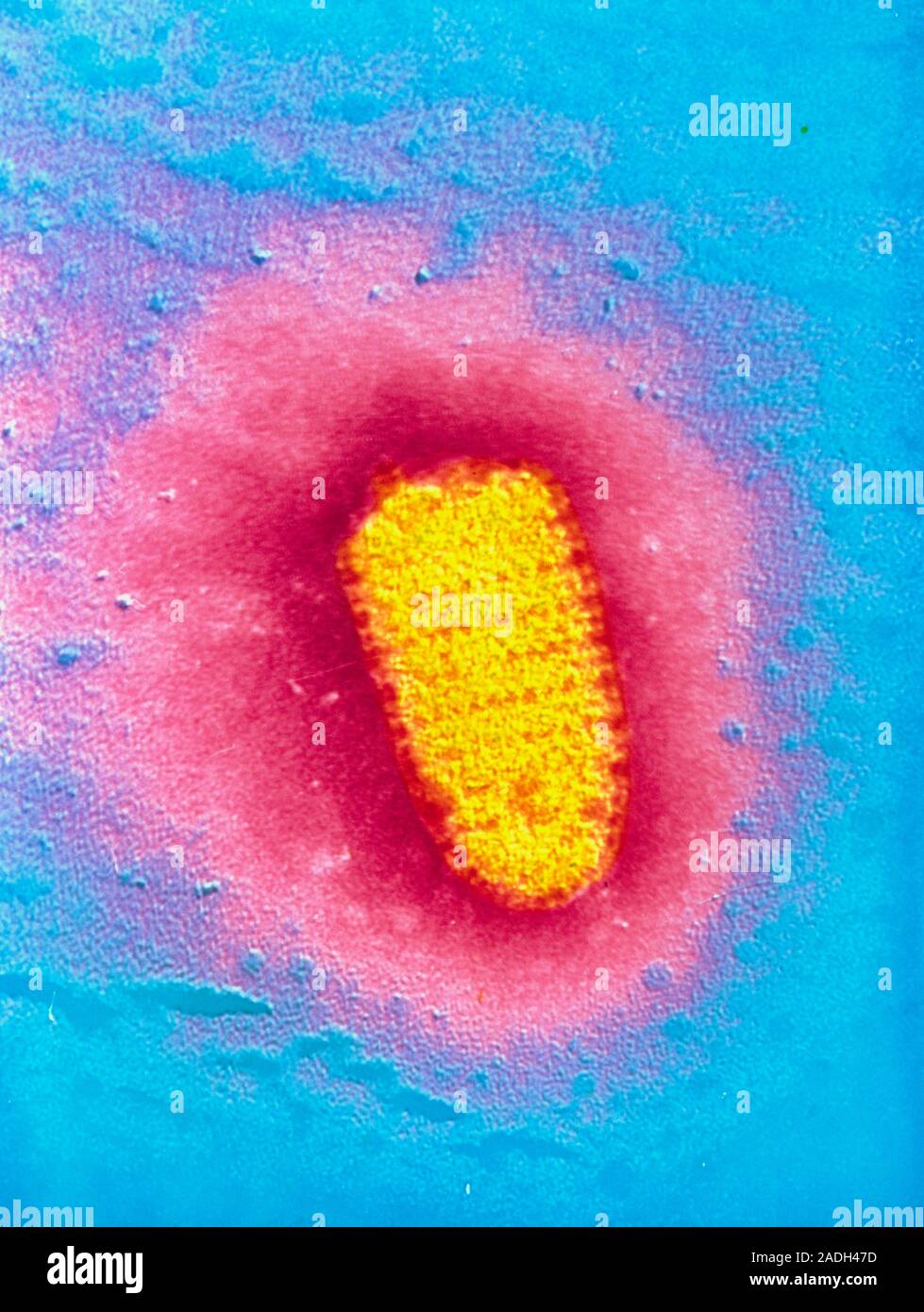 False colour transmission electron micrograph of the bullet-shaped ...